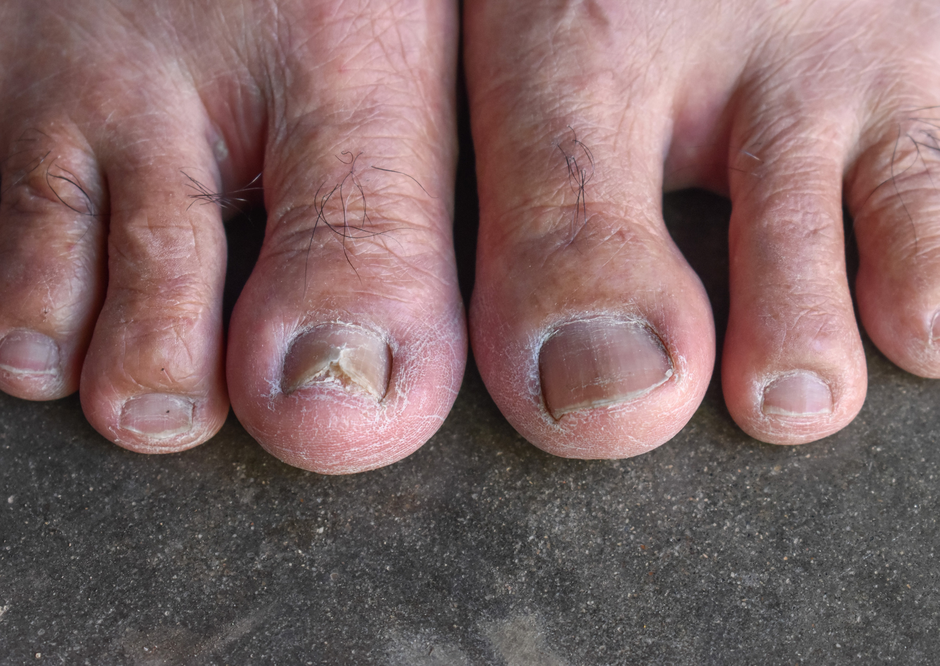 Ageing Feet - Smile & Move Polyclinic