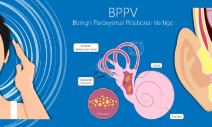 BPPV – Vertigo - Smile & Move Polyclinic